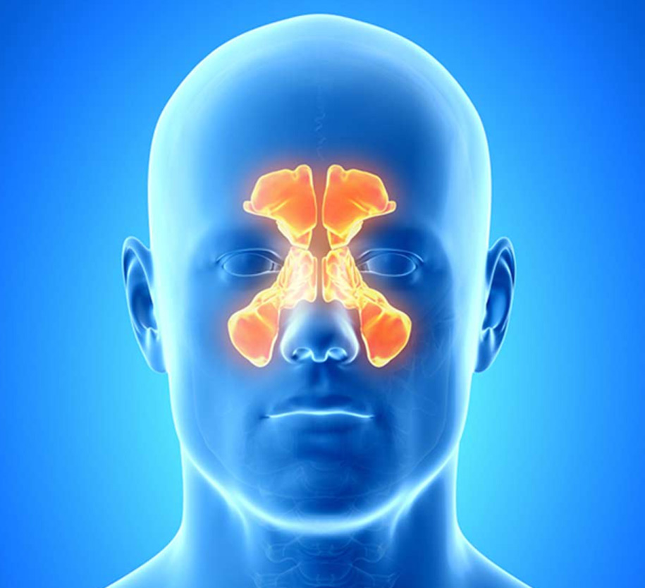 Cerebrospinal Fluid Leak | UCI Head and Neck Surgery - UCI ENT Doctors ...