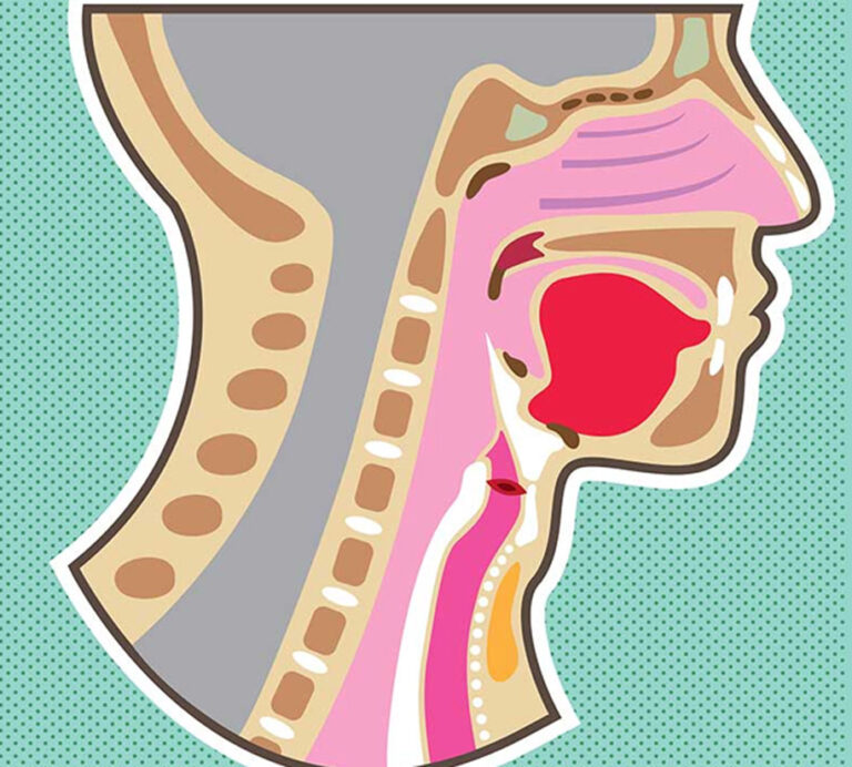 Nasal Polyps | UCI Head and Neck Surgery - UCI ENT Doctors ...