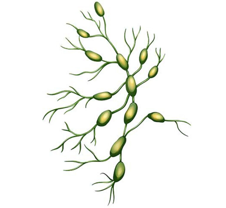 Neck Dissection | UCI Head and Neck Surgery - UCI ENT Doctors ...