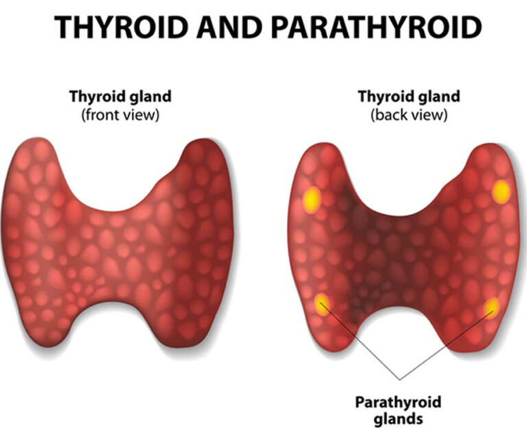 Parathyroid Anatomy | UCI Head and Neck Surgery - UCI ENT Doctors ...