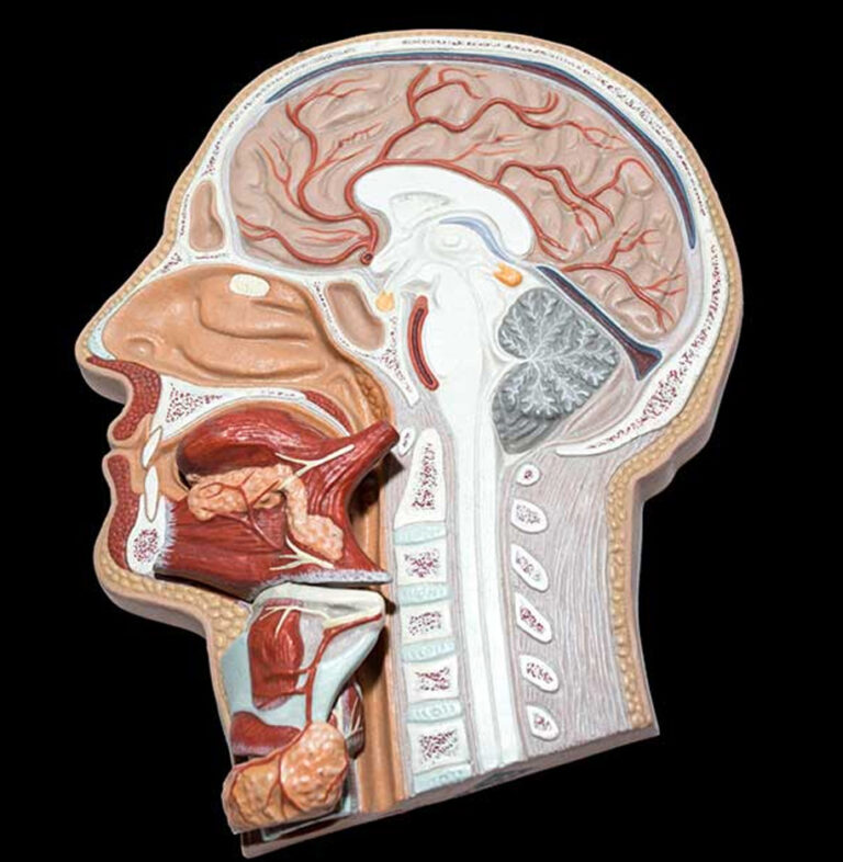 Zenker’s Diverticulum | UCI Head and Neck Surgery - UCI ENT Doctors ...